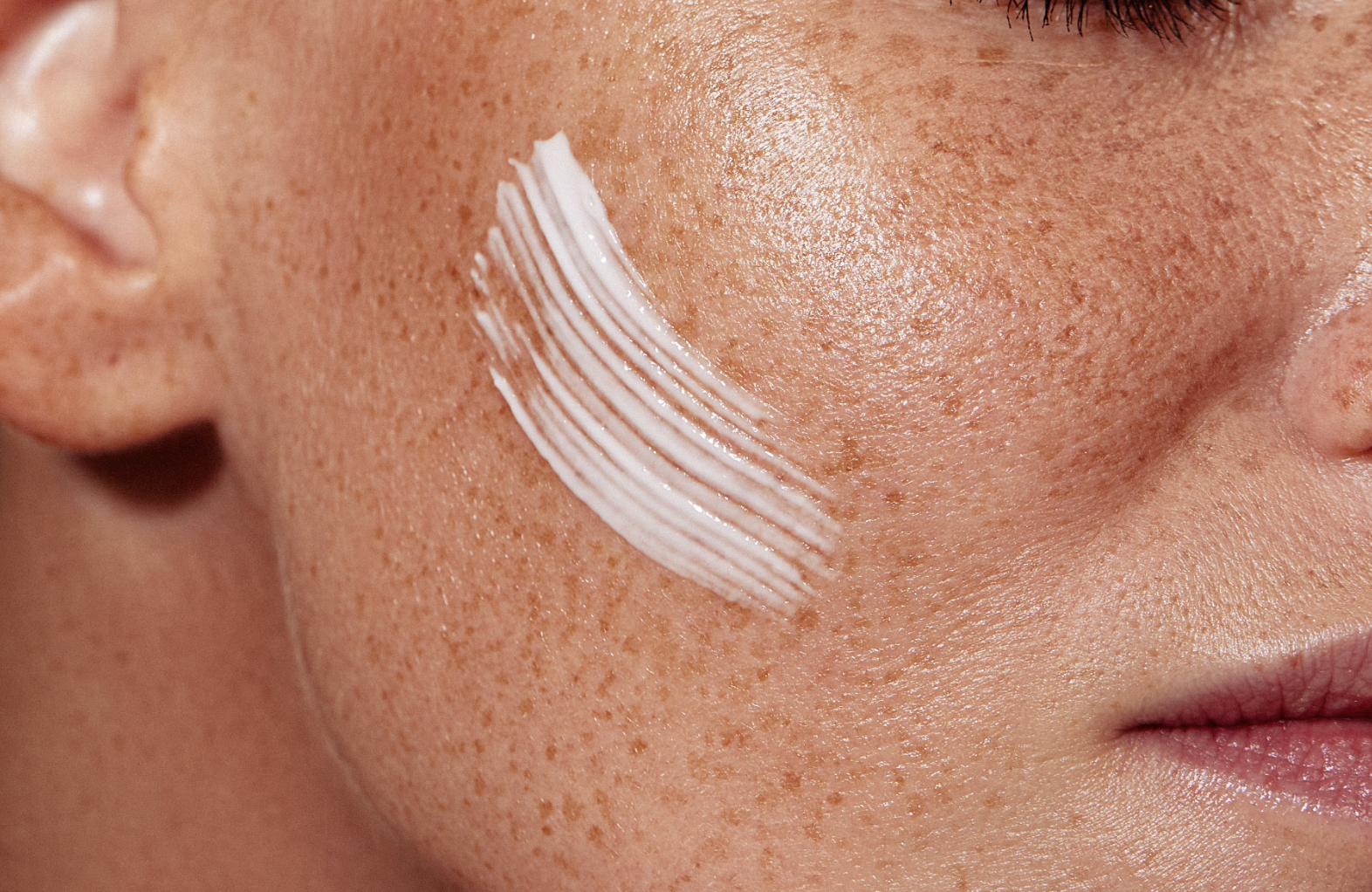 How Do You Treat & Clear Up Rosacea Pustules and Papules? | Foundation ...