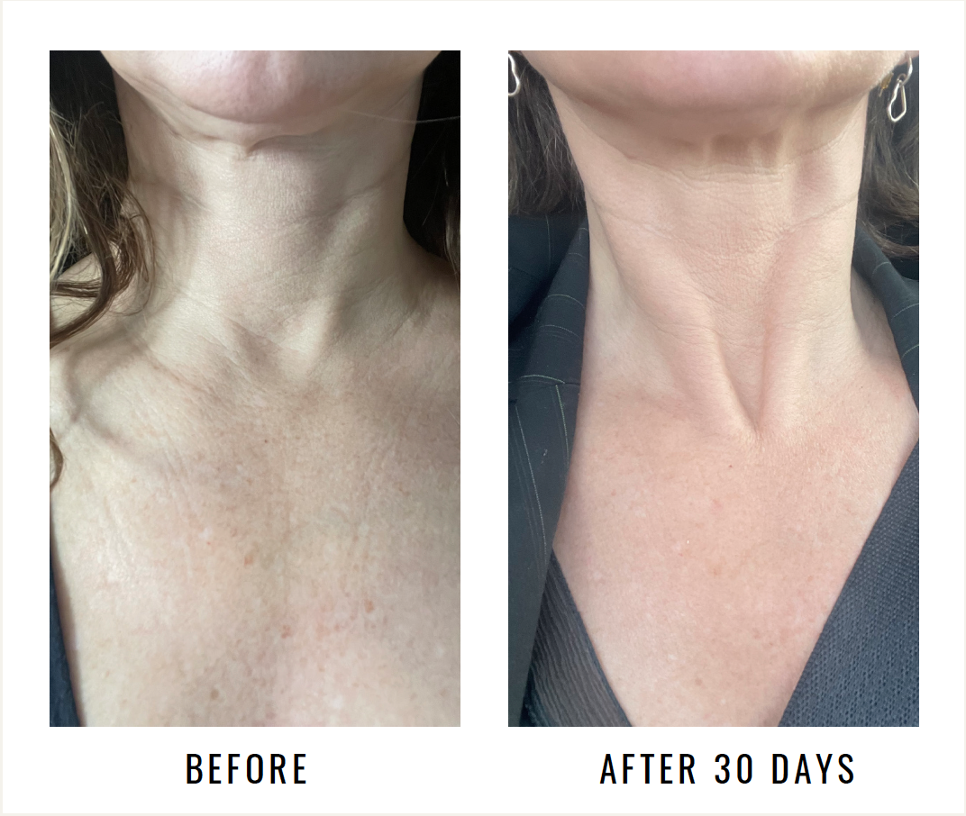 Firming Neck Cream - Best Cream To Firm Neck Skin & Reduce Neck ...